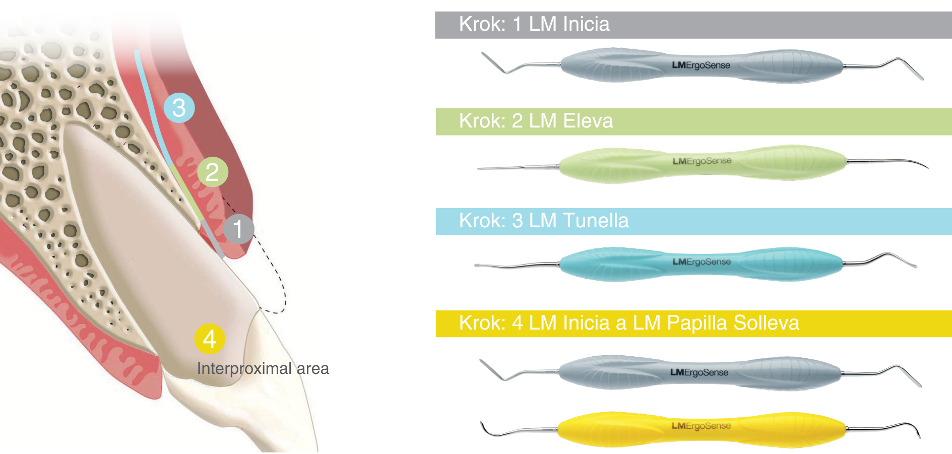 Parodontální chirurgie - HDT s.r.o.